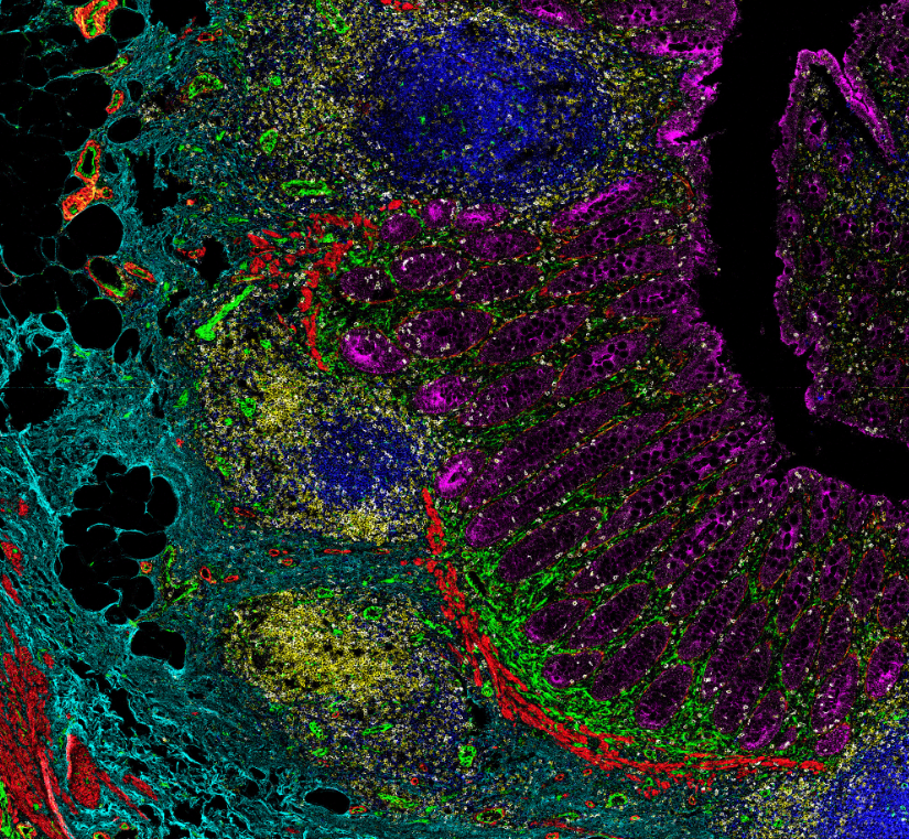 Spatial Proteomics | Standard BioTools