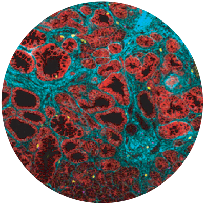 Immuno-Oncology With Imaging Mass Cytometry | Standard BioTools